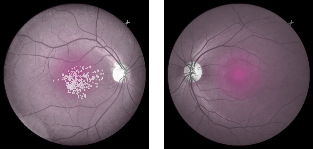 ColorDx CCT HD High Precision Color Vision Testing | Konan Medical