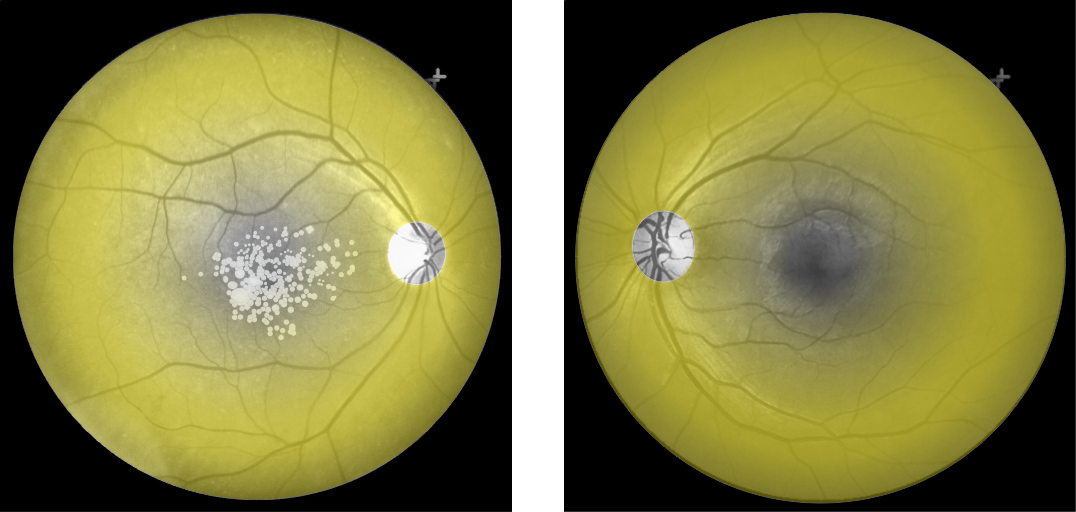 ColorDx CCT HD High Precision Color Vision Testing | Konan Medical