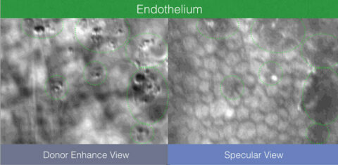 CellChek D | D+ Specular Microscopes for Eye Banks | Konan Medical