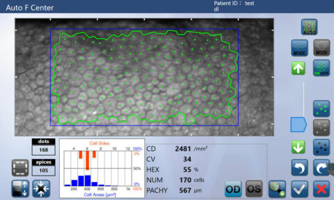 CellChek®️️️️ 20 & 20PLUS Specular Microscope | Konan Medical