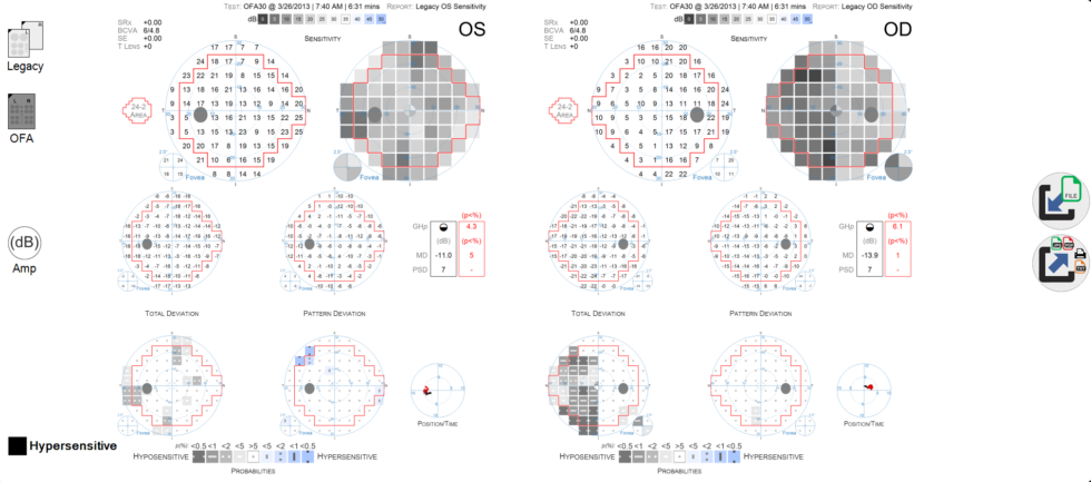 objectiveFIELD®️️️ | Objective Field Analyzer | Konan Medical
